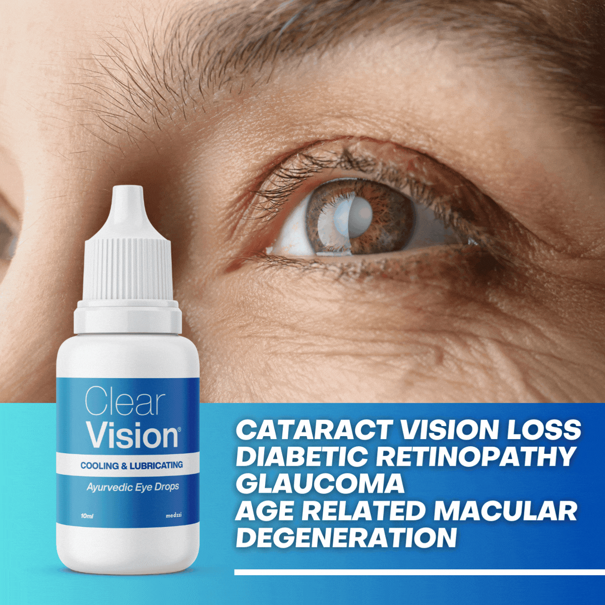 Clear Vision Eye Drops 10ml | medzzi Ayurvedic Eye Drops – Medzzi